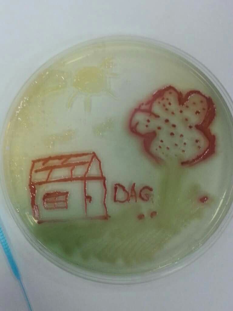 Diyari 🖤's post on Goodwall - Drawing on agar plate by using 3 types of ...